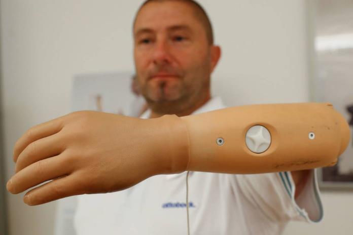 Donarán 100 prótesis de mano a personas de la ZMG